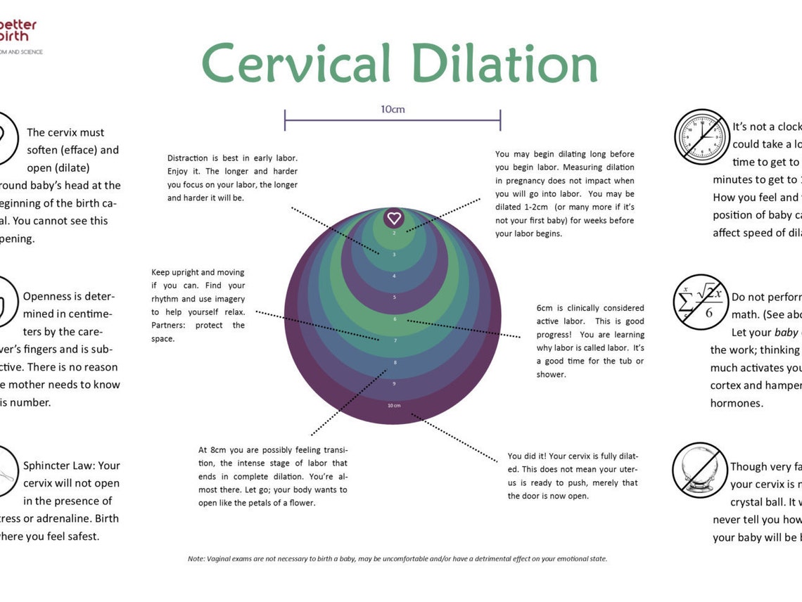 Cervix Poster! Labor and Birth Dilation-11x17 Printable for Midwives - Etsy