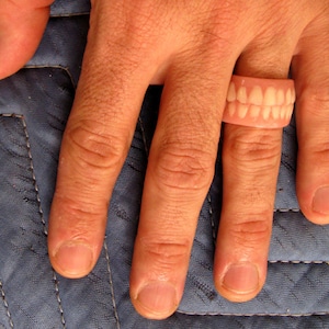 Denture Ring - Etsy