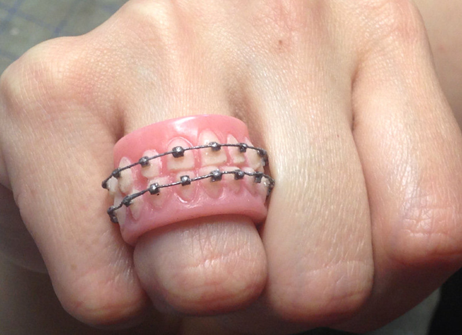 Braces Ring | Etsy