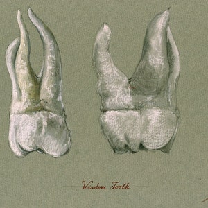 Dental Print - Widsom Teeth Tooth - Dentistry Art Poster Teeth -science ...