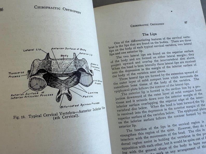 1948 Chiropractic Orthopedy Science Medicine Antique Medical Anatomy - Etsy