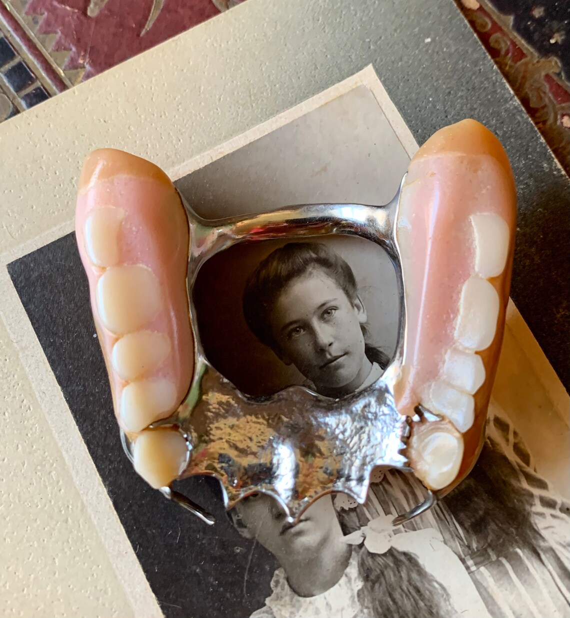 Vintage Partial Denture False Teeth Vintage Found Used Worn - Etsy