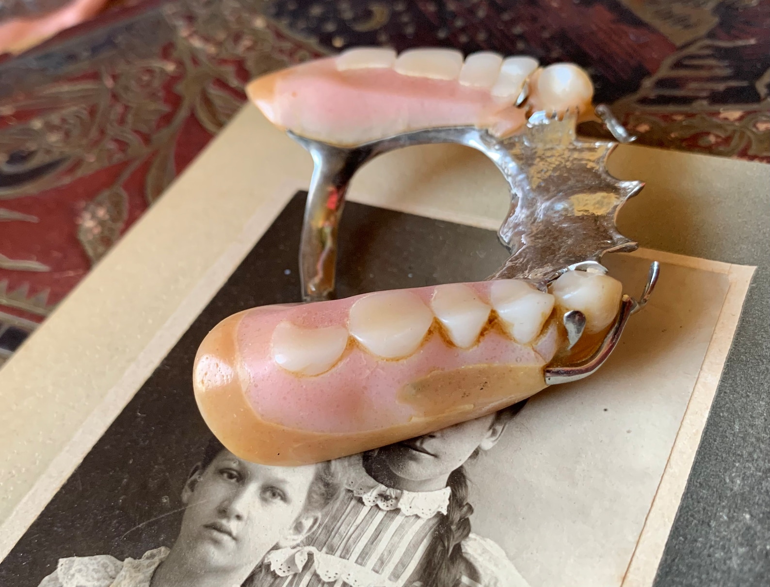 Vintage Partial Denture False Teeth Vintage Found Used Worn - Etsy