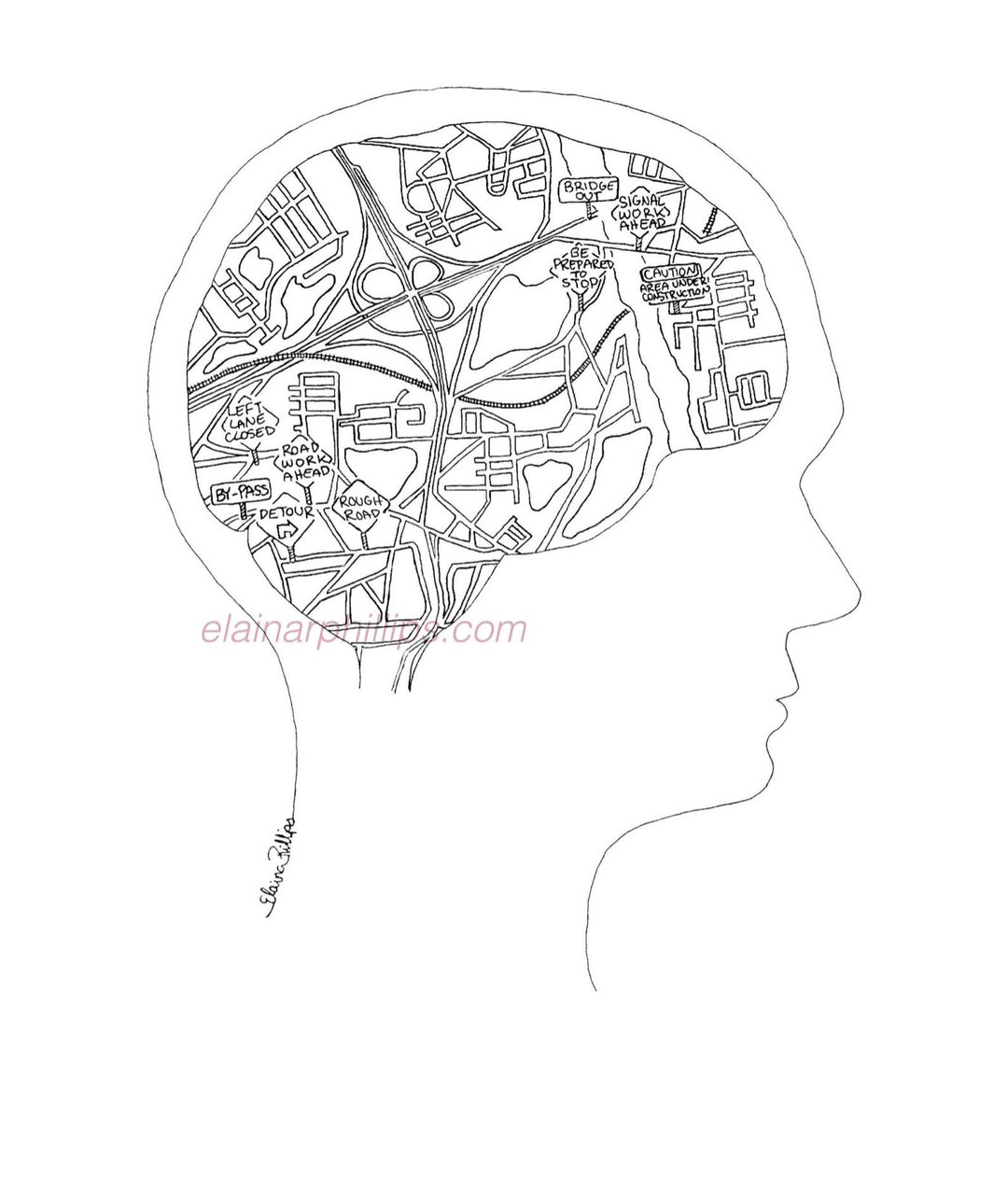 Concussion Brain Map Encouragement Card or Poster Traumatic - Etsy