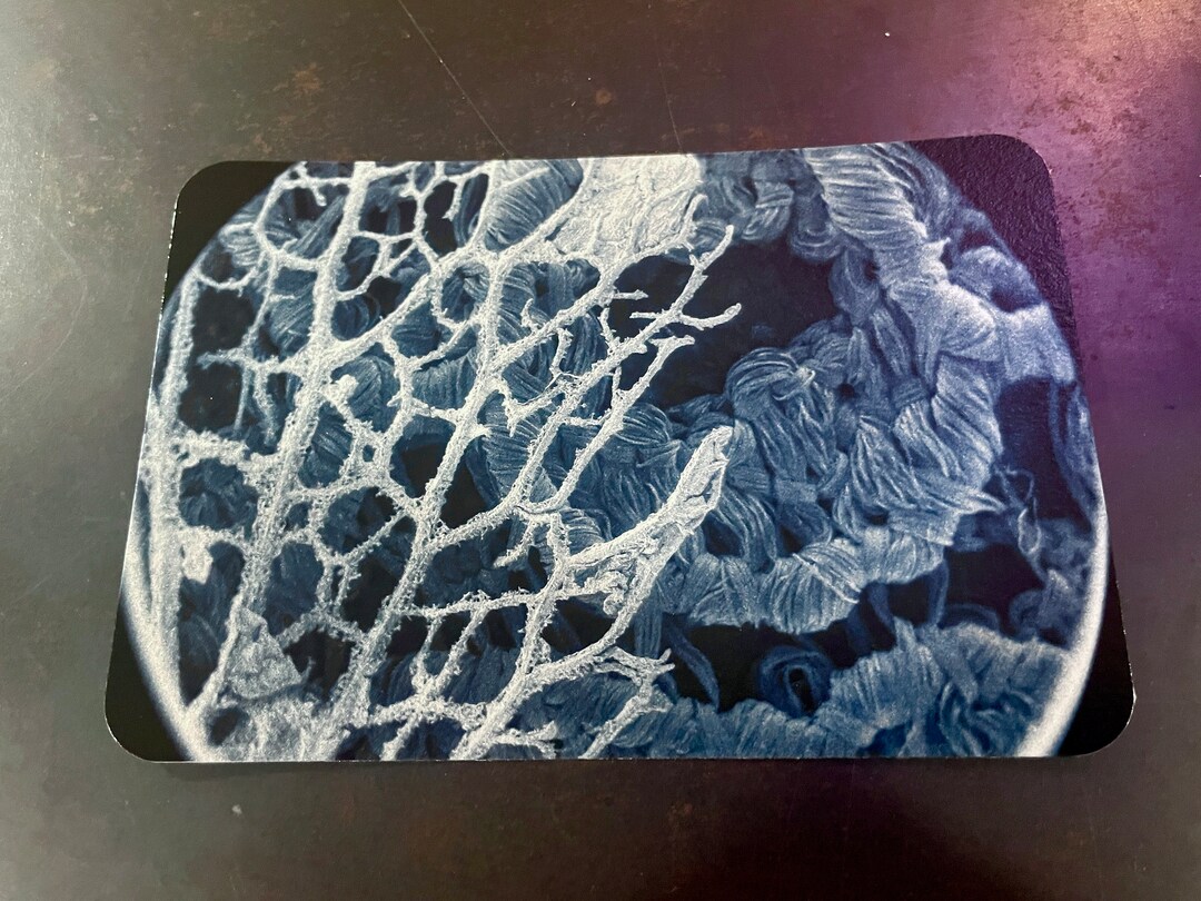 Lace on Lace Postcard, Electron Microscope Picture of Lace (fabric ...