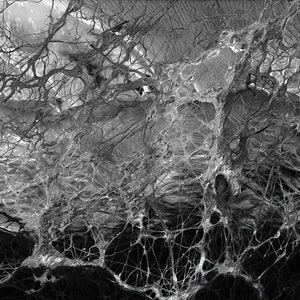 Spiderweb Under the Electron Microscope, Spiderweb Covering a Roly Poly ...