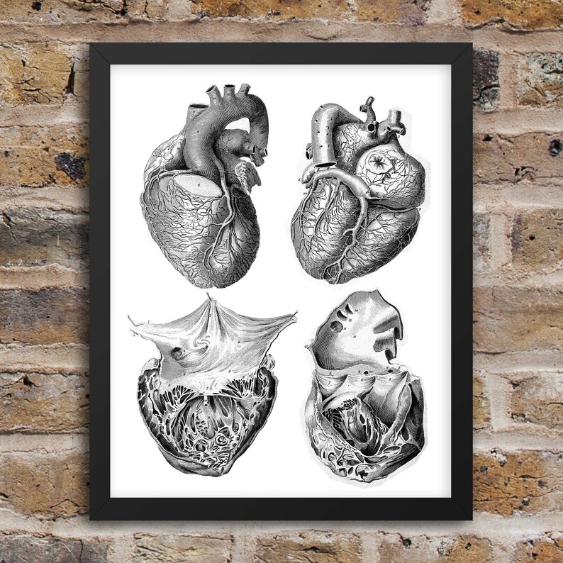 Human Heart Dissection Art Print Book Plate Illustration Home | Etsy