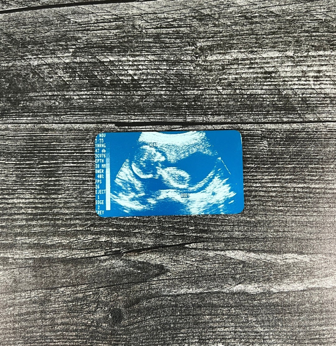 Metal Ultrasound Photo Wallet Insert, Personalized Wallet Card ...