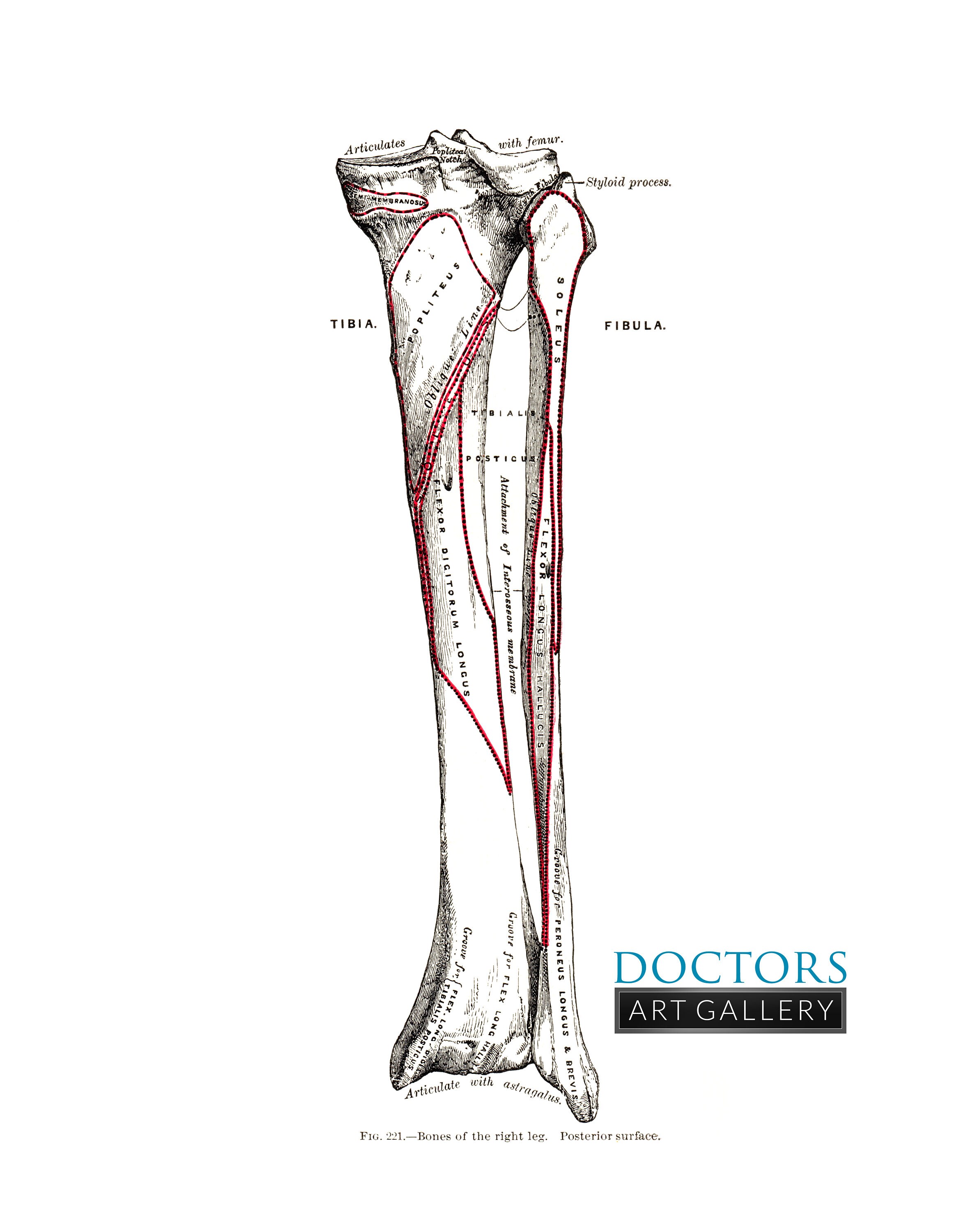 Fibula Tibia Leg Bone Ortho Vintage Human Anatomy Art Print - Etsy ...