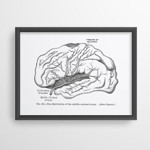 Cerebral Artery Brain Neurology Human Anatomy Vintage Art Print Medical ...