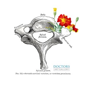 Vertebra Prominens Cervical Spine Bone Vintage Osteology Floral Anatomy ...