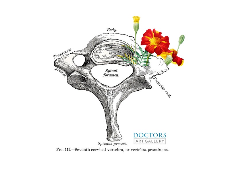 Vertebra Prominens Cervical Spine Bone Vintage Osteology Floral Anatomy ...