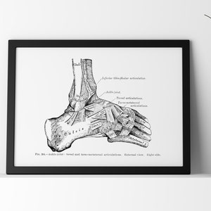 Ankle Joint Tarsal and Tarso-metatarsal Articulation Vintage Human ...