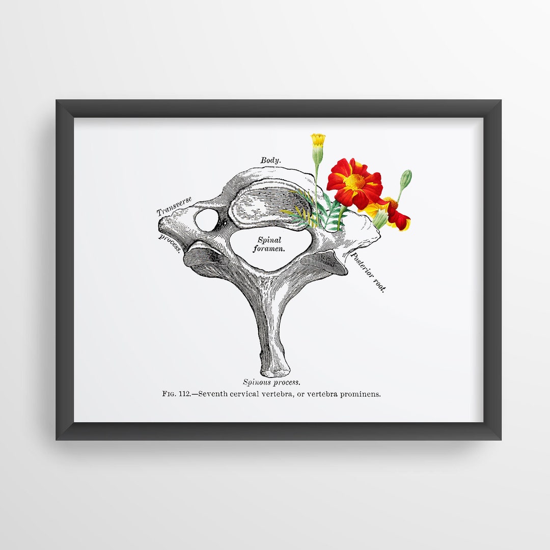 Vertebra Prominens Cervical Spine Bone Vintage Osteology Floral Anatomy ...