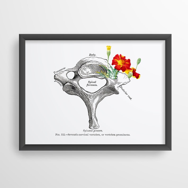 Vertebra Prominens Cervical Spine Bone Vintage Osteology Floral Anatomy ...