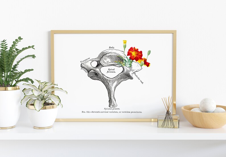 Vertebra Prominens Cervical Spine Bone Vintage Osteology Floral Anatomy ...