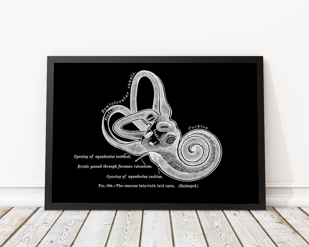 Cochlea Osseous Labyrinth Inner Ear ENT Dark Vintage Audiology Anatomy ...