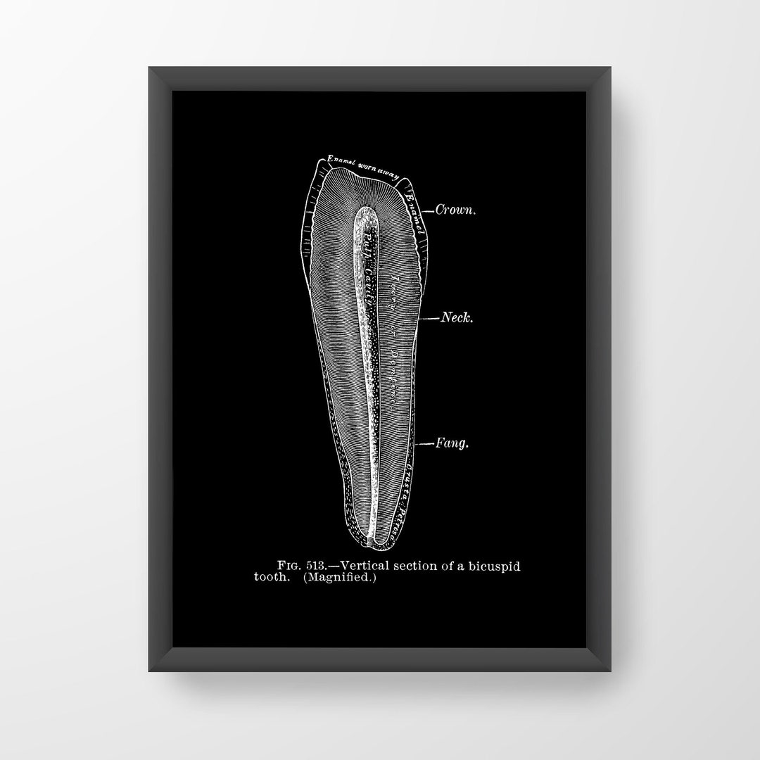 Bicuspid Tooth Structure Dental Orthodontic Oral Surgery X-ray Black ...