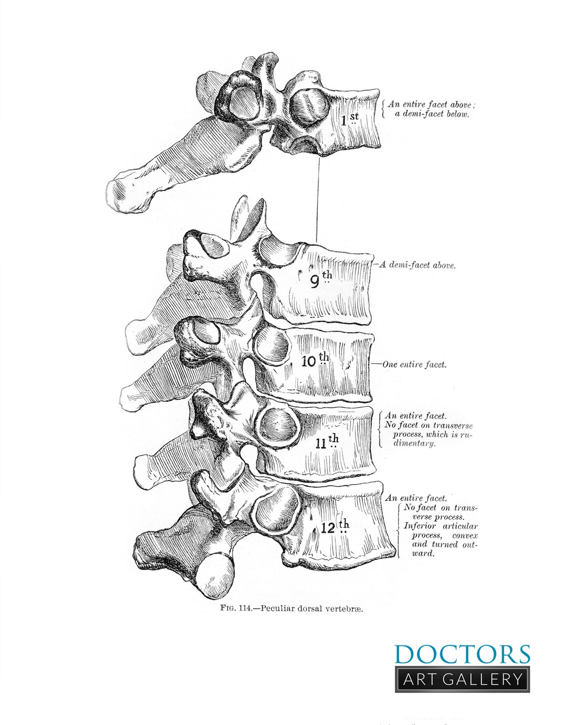 Dorsal Thoracic Spine Osteology Vertebrae Bone Vintage Human Anatomy ...