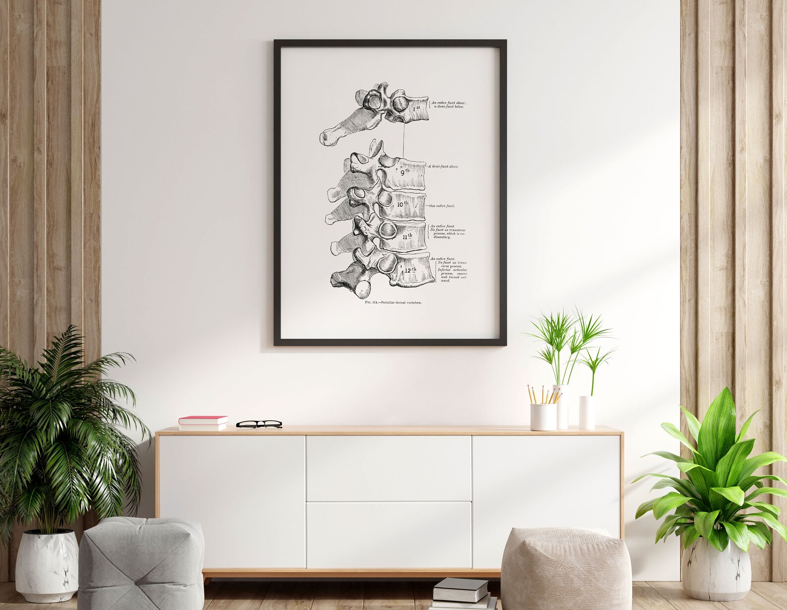 Dorsal Thoracic Spine Osteology Vertebrae Bone Vintage Human Anatomy ...