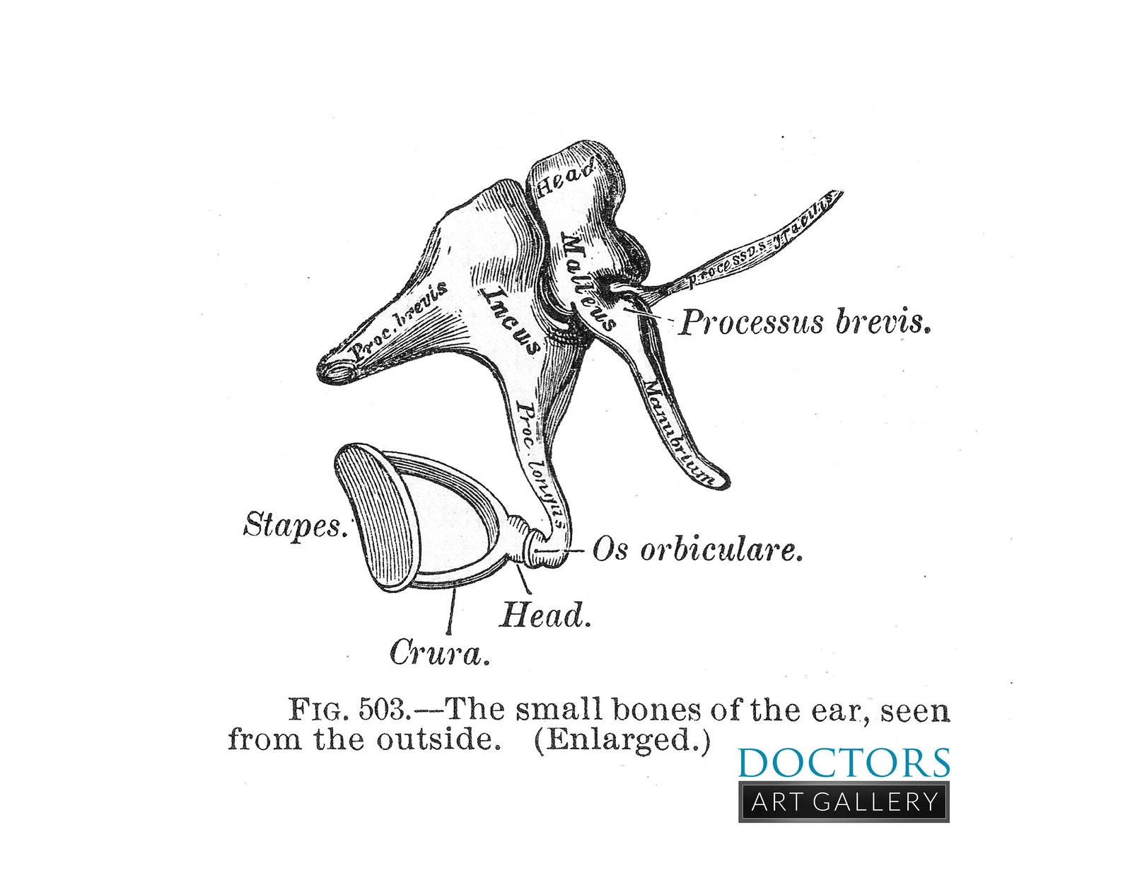 Ossicule, petits os de l'oreille ORL, audiologie, anatomie, vintage ...