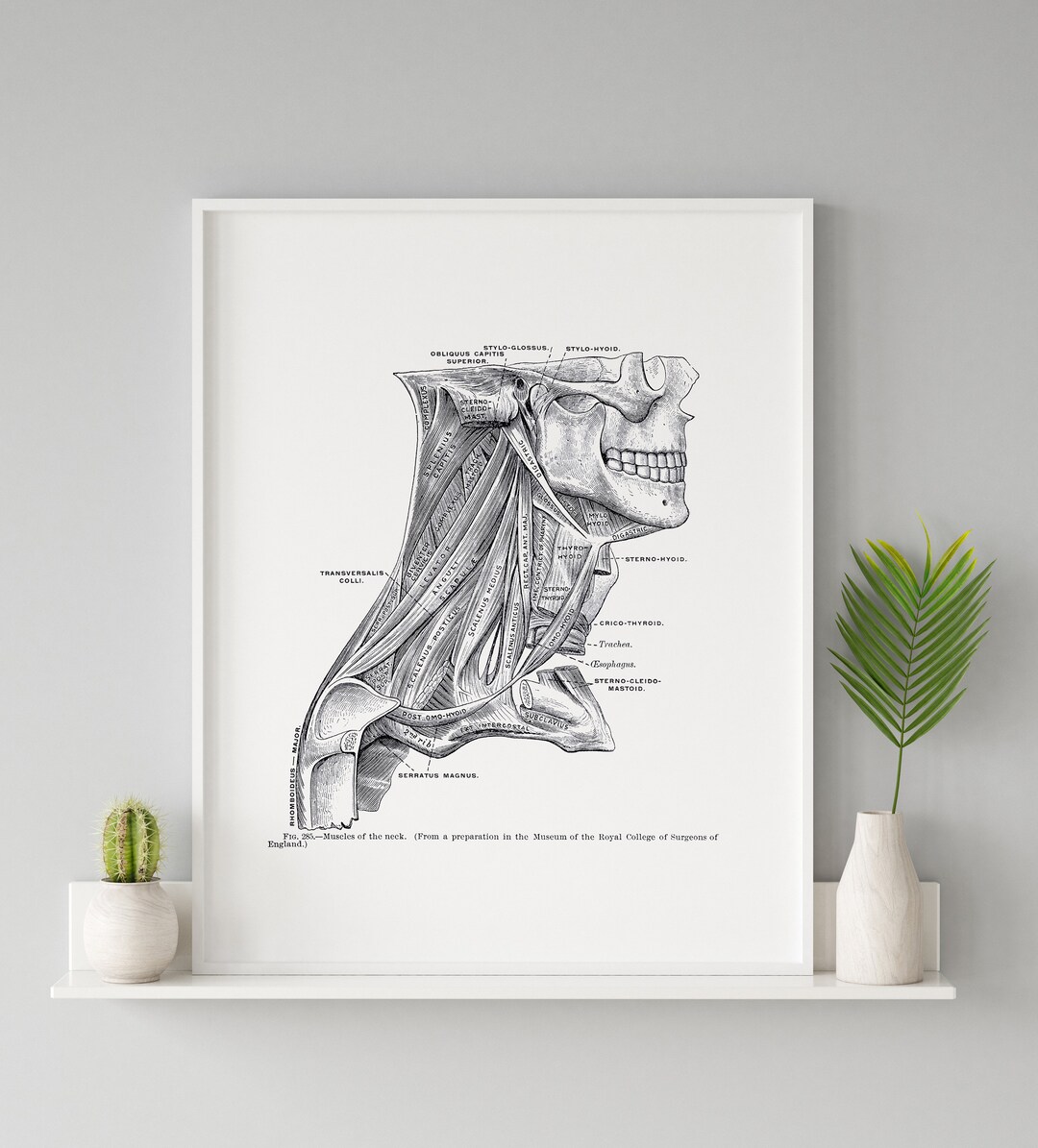 Neck Muscle Sternohyoid Sternocleidomastoid Digastric Vintage Human ...