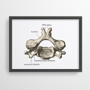 4th Cervical Vertebra Spine Vintage Human Anatomy Art Print - Etsy