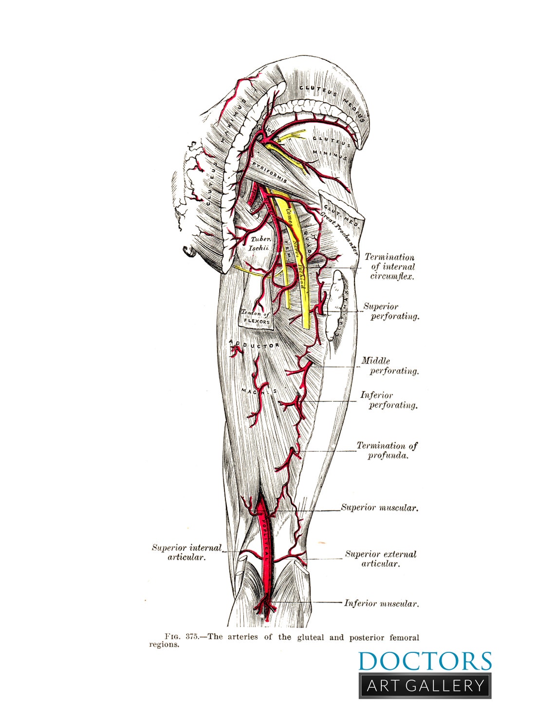 Surgical Anatomy Sciatic Artery Gluteal and Posterior Femoral - Etsy