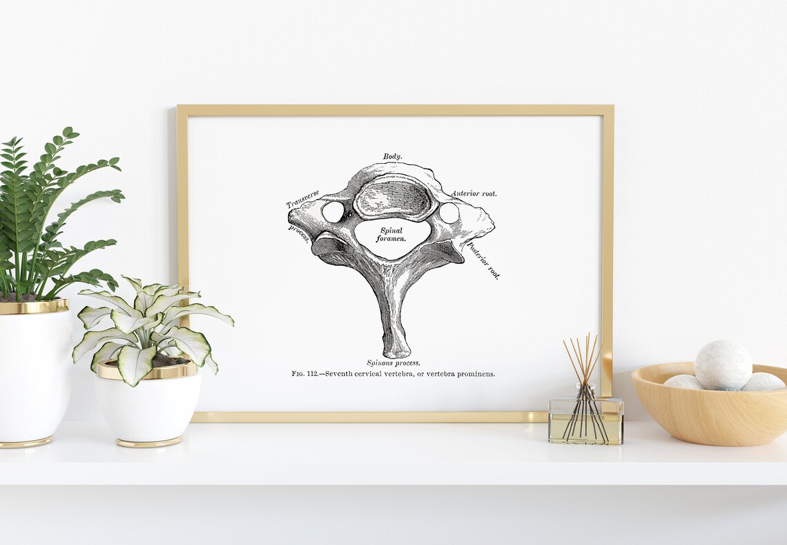 Vertebra Prominens Cervical Spine Bone Vintage Osteology Human Anatomy ...