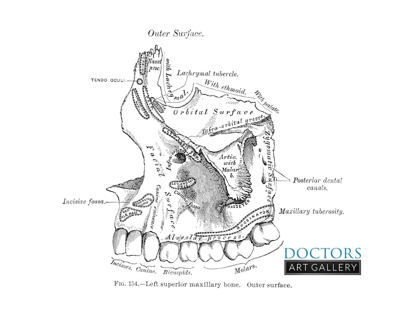 Maxillary Bone Superior Dental Orthodontic Maxillofacial Oral Surgery ...
