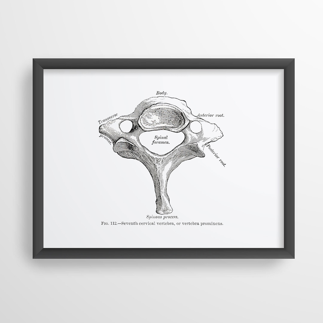 Vertebra Prominens Cervical Spine Bone Vintage Osteology Human Anatomy ...