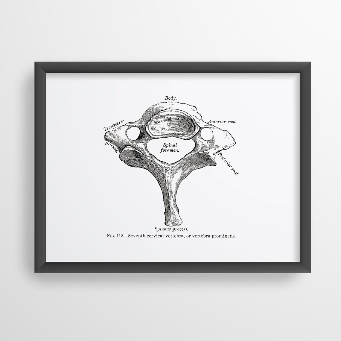 Vertebra Prominens Cervical Spine Bone Vintage Osteology Human Anatomy ...