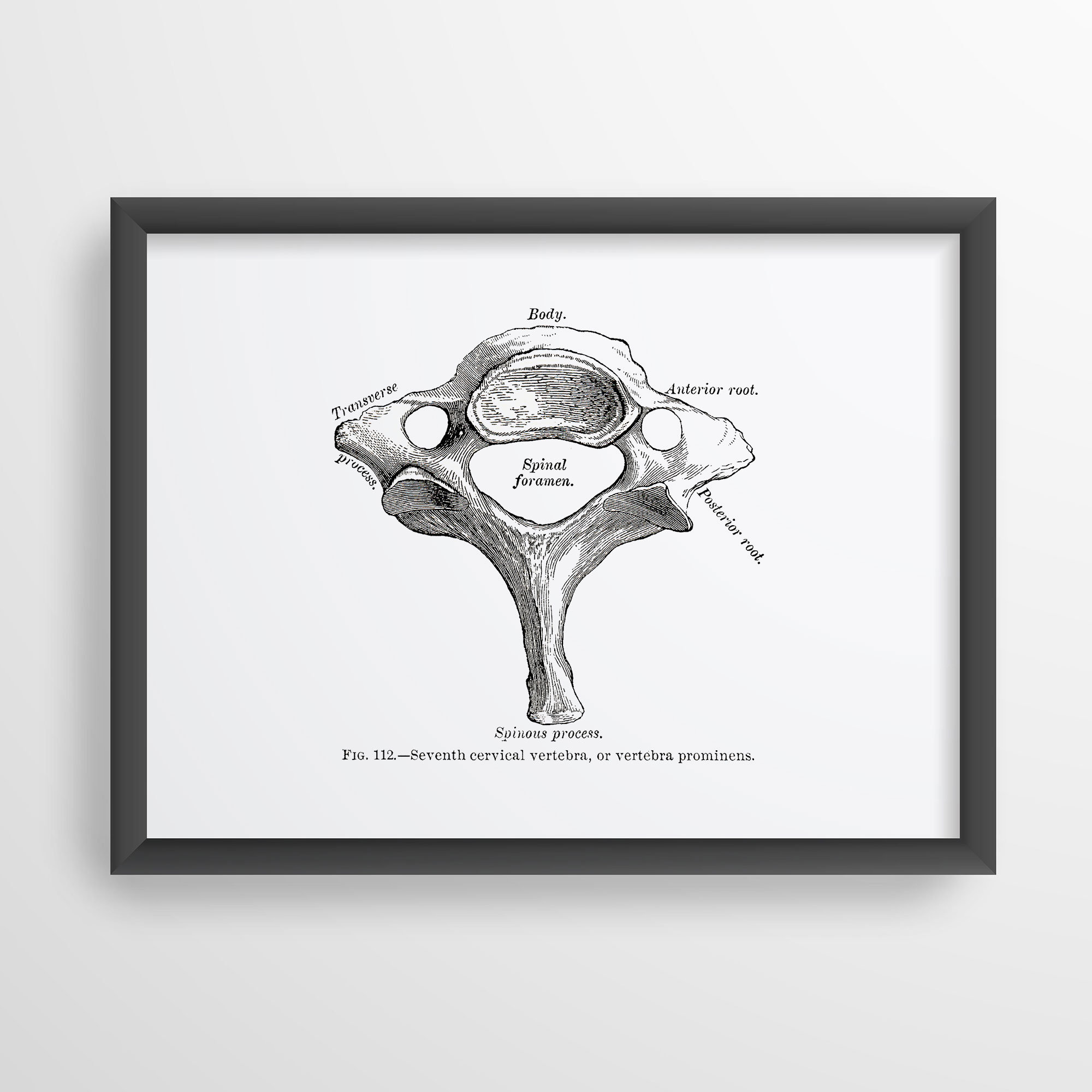 Spine Vertebrae Drawing