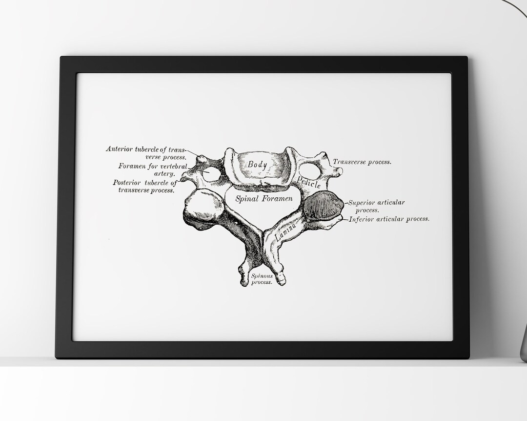 Cervical Vertebra Spine Bone Vintage Osteology Anatomy Art Print ...