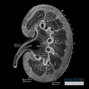 Kidney Urology Nephrology Human Anatomy Art Print Dialysis Medical ...