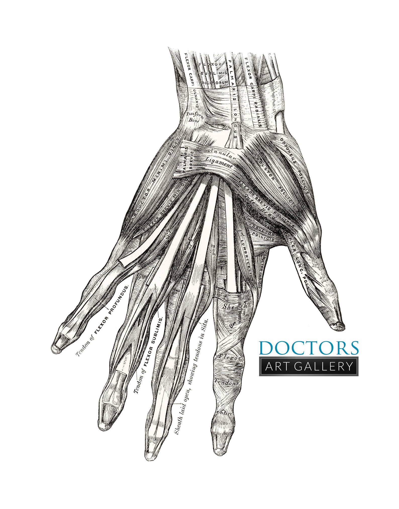 Hand Flexor Muscle Ligament Tendon Vintage Anatomical Art Print Medical ...