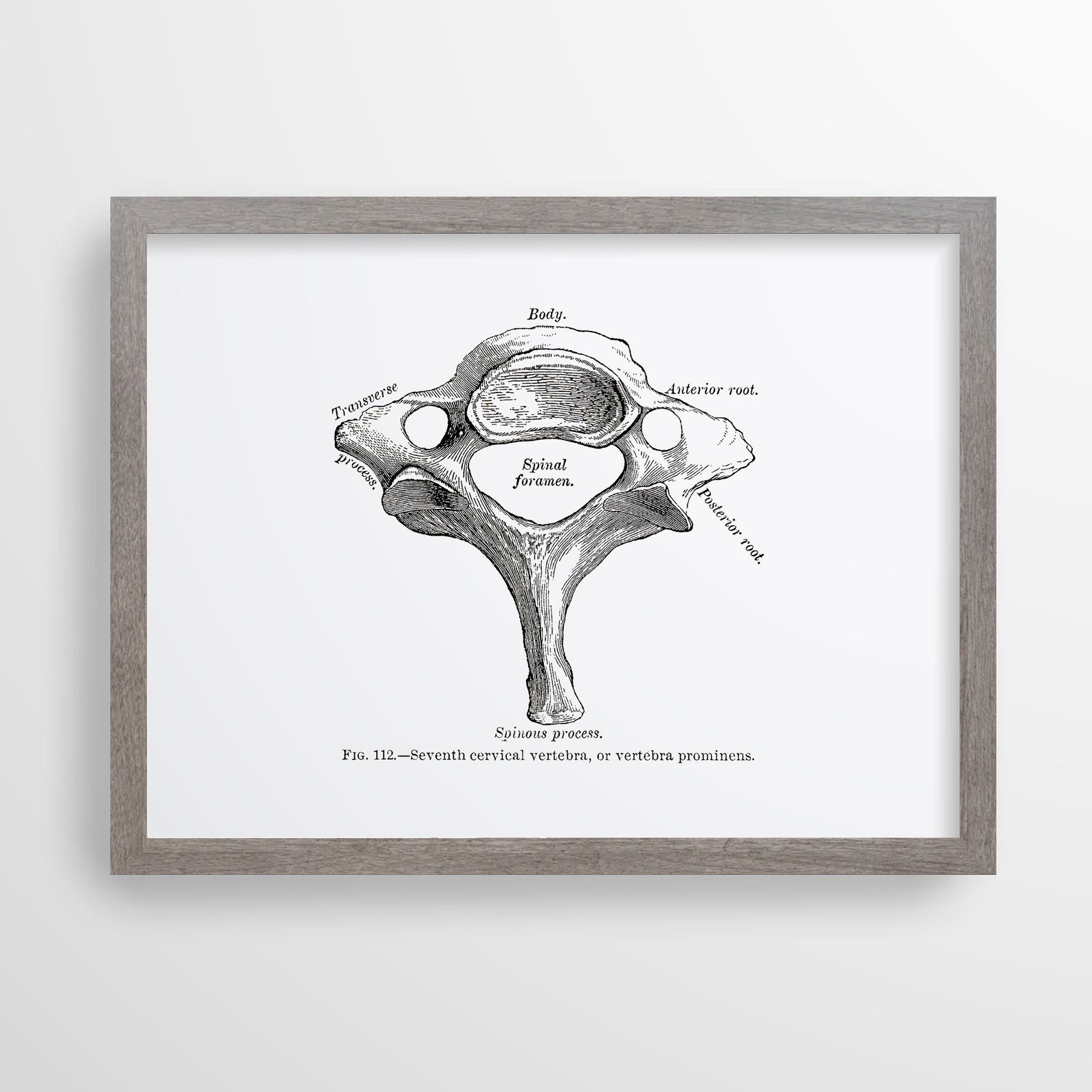 Vertebra Prominens Cervical Spine Bone Vintage Osteology Human Anatomy ...