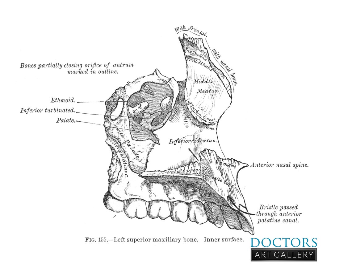 Maxillary Bone Dental Orthodontic Maxillofacial Oral Surgery | Etsy