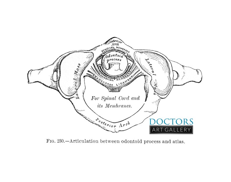 Articulation Between Odontoid Process and Atlas Cervical Vertebra Spine ...