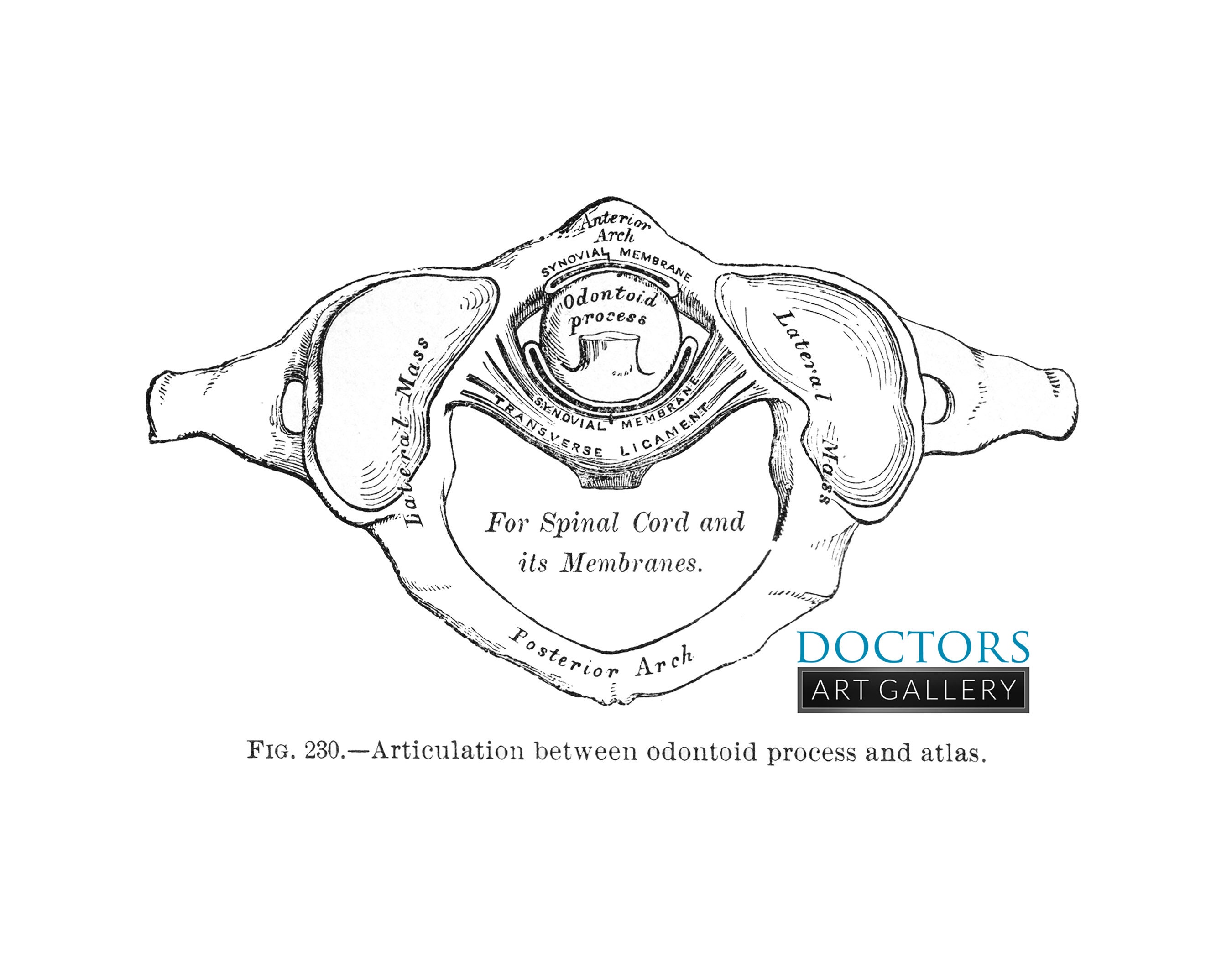 Articulation Between Odontoid Process and Atlas Cervical Vertebra Spine ...