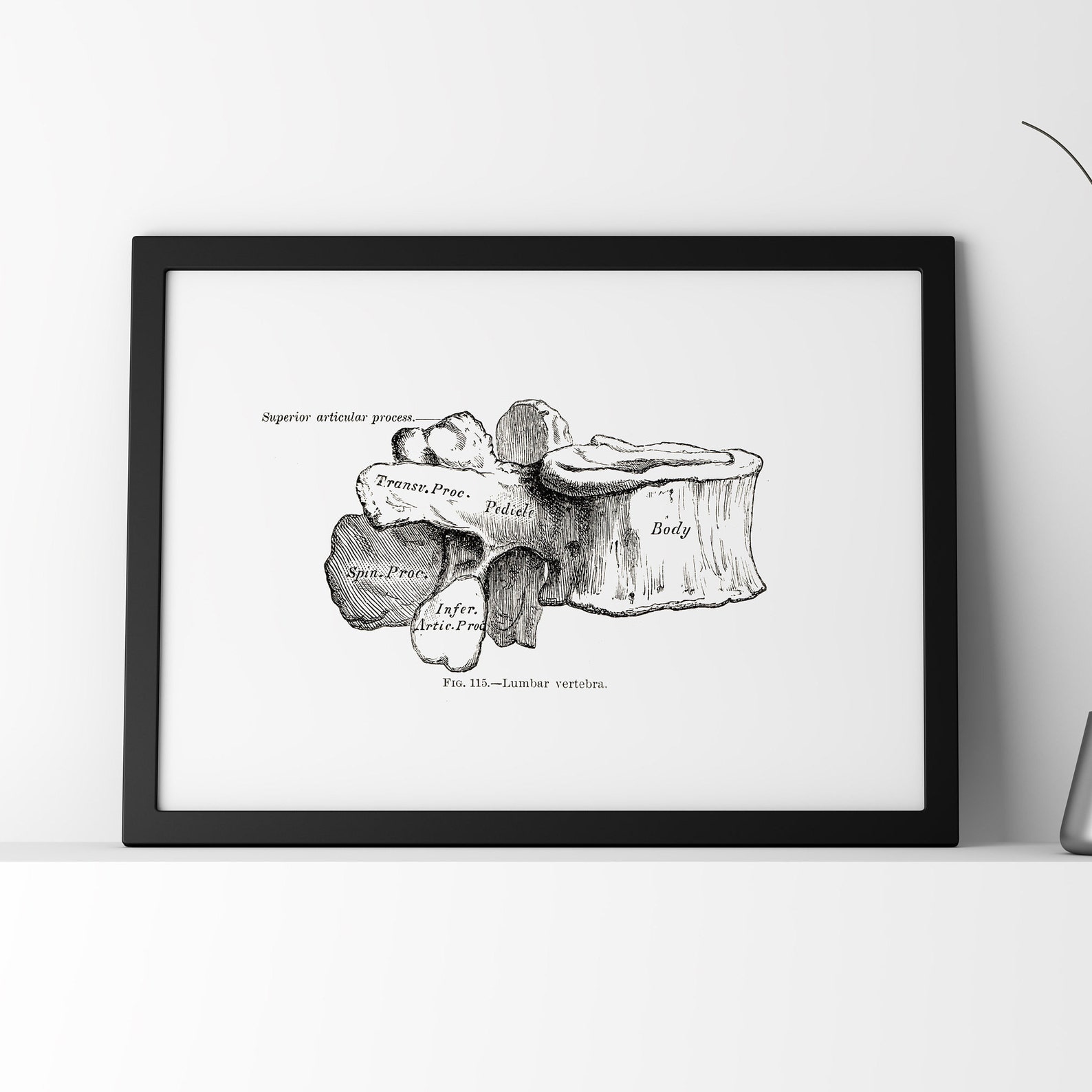 Lumbar Vertebra Spine Bone Vintage Osteology Human Anatomy Art Print - Etsy