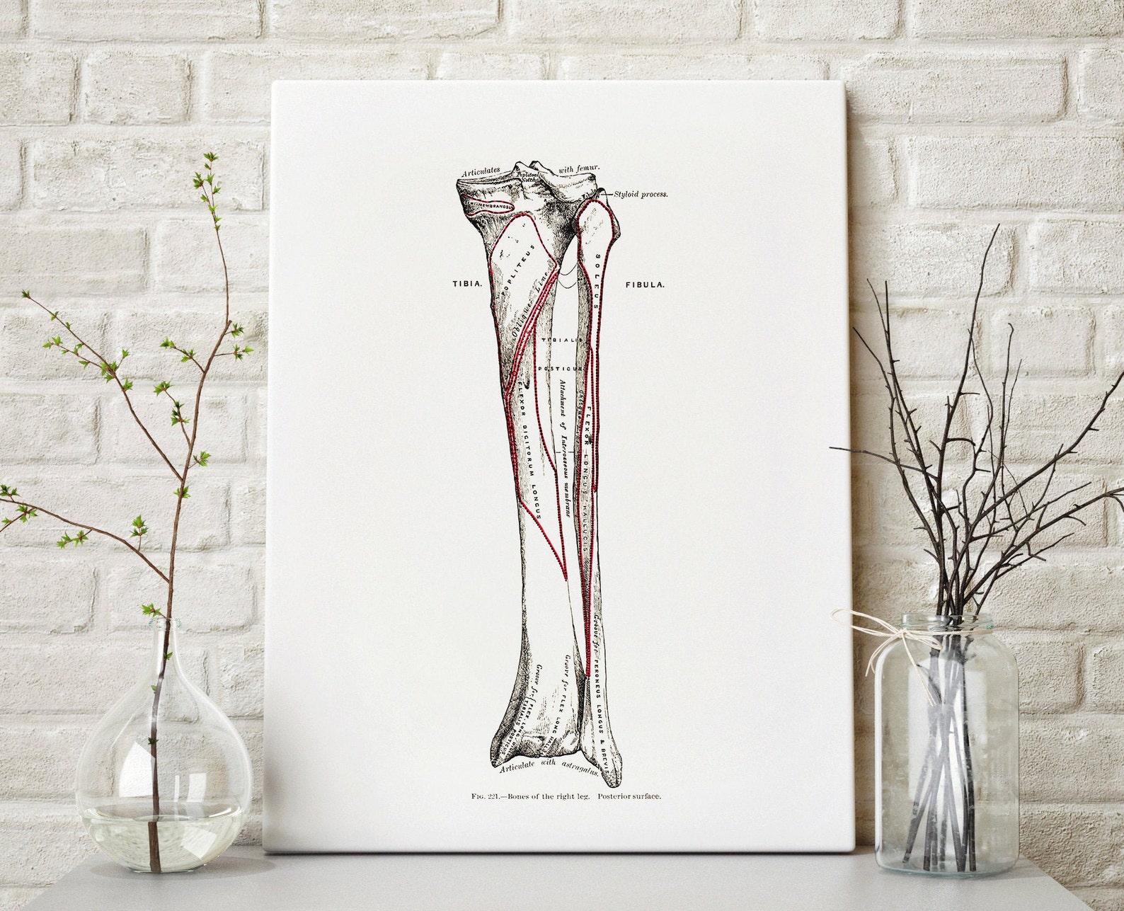 Vintage Tibia Fibula Leg Bone Anatomy Osteology Art Print - Etsy