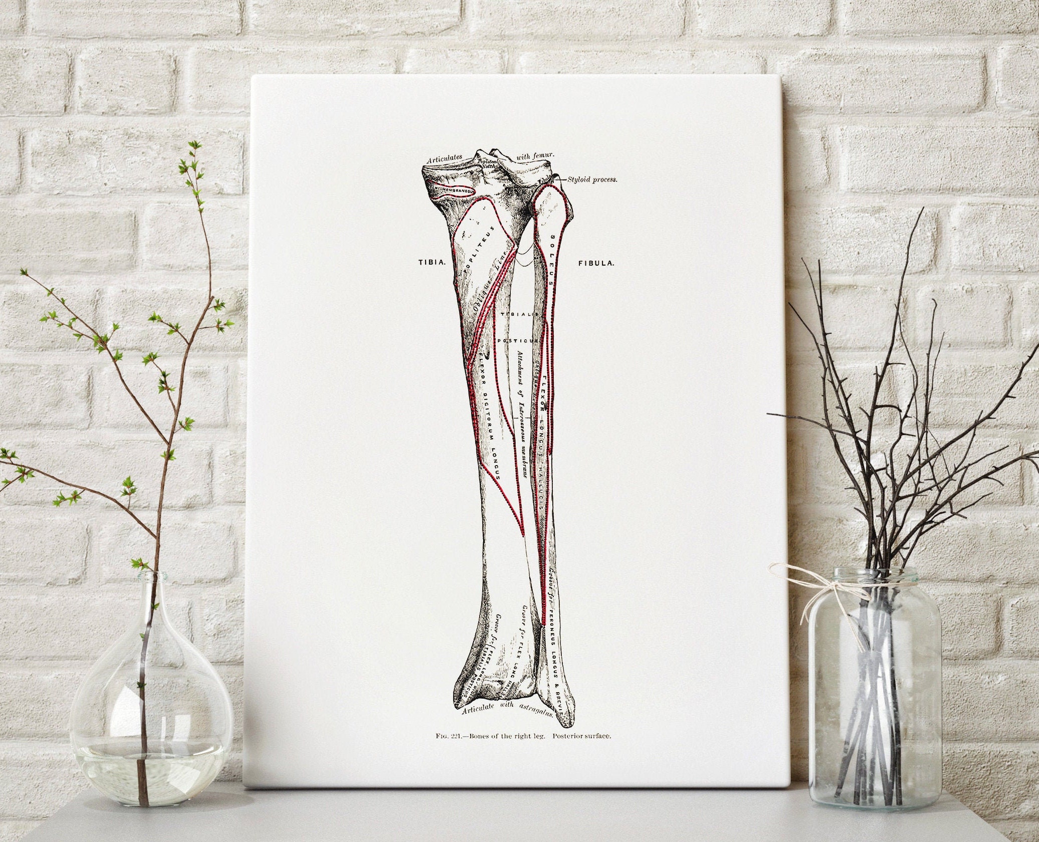Vintage Tibia Fibula Leg Bone Anatomy Osteology Art Print - Etsy