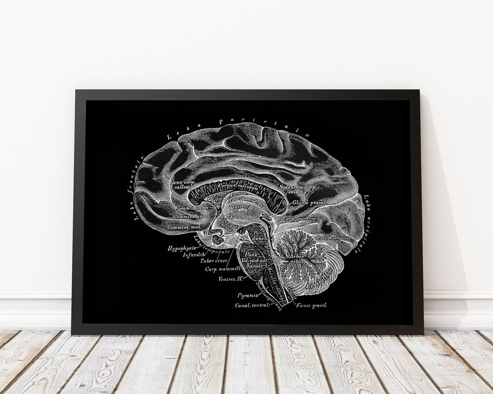 Lateral Brain Neurology Human Anatomy Vintage Art Print - Etsy