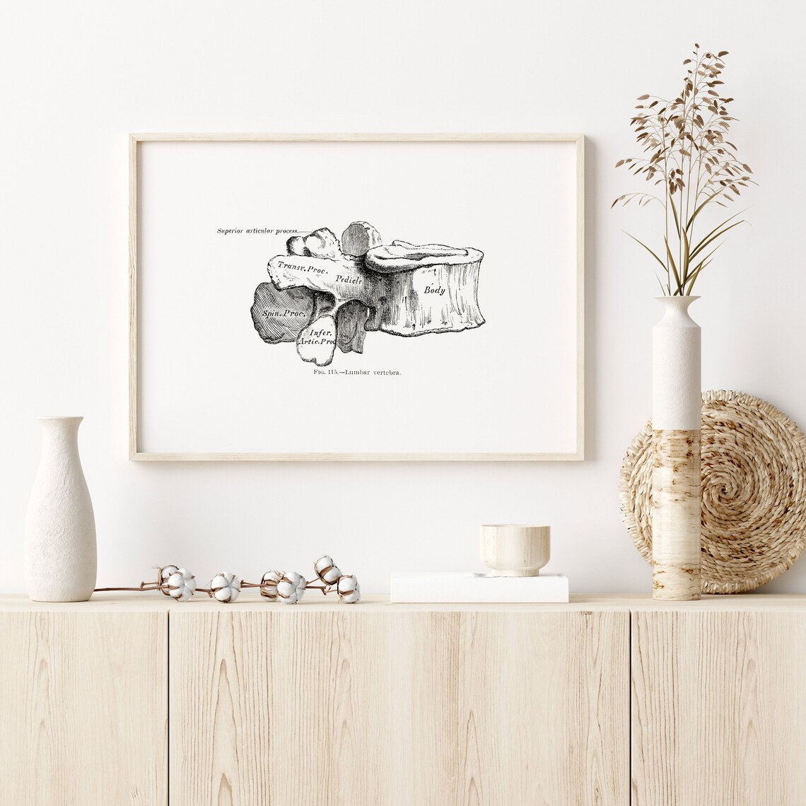 Lumbar Vertebra Spine Bone Vintage Osteology Human Anatomy Art Print - Etsy