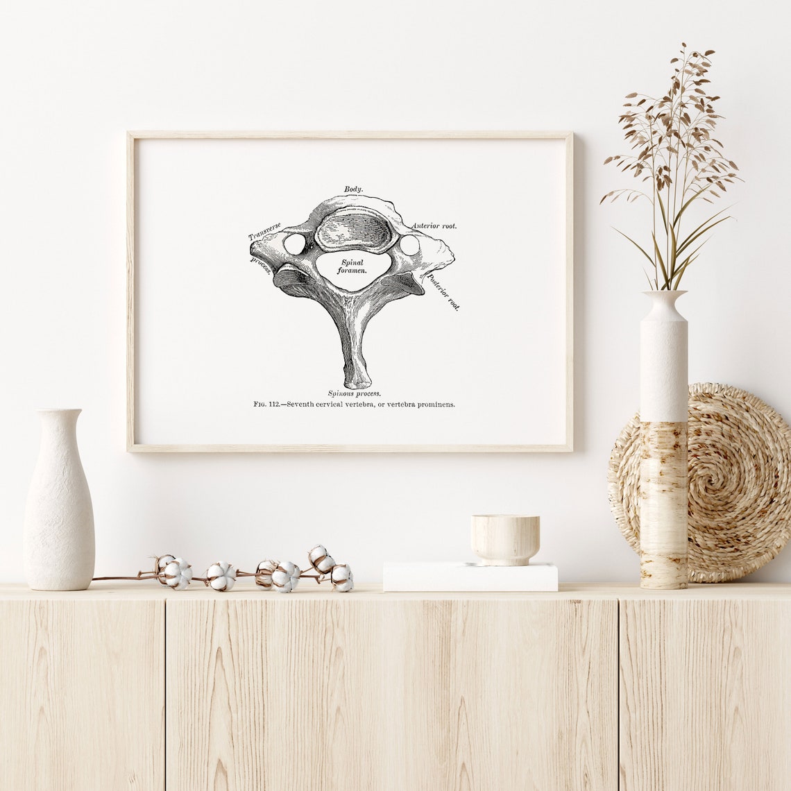 Vertebra Prominens Cervical Spine Bone Vintage Osteology Human Anatomy ...