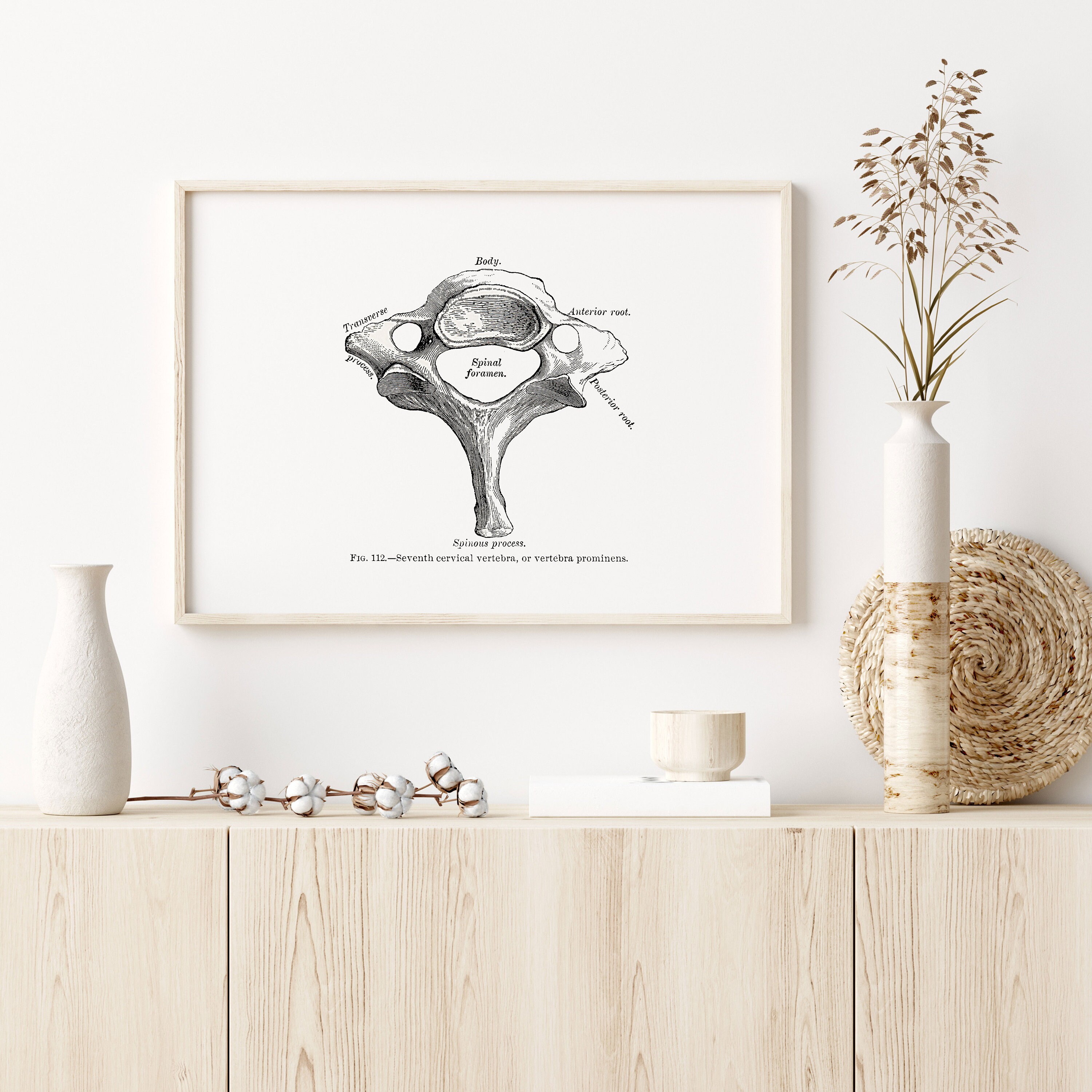 Vertebra Prominens Cervical Spine Bone Vintage Osteology Human Anatomy ...