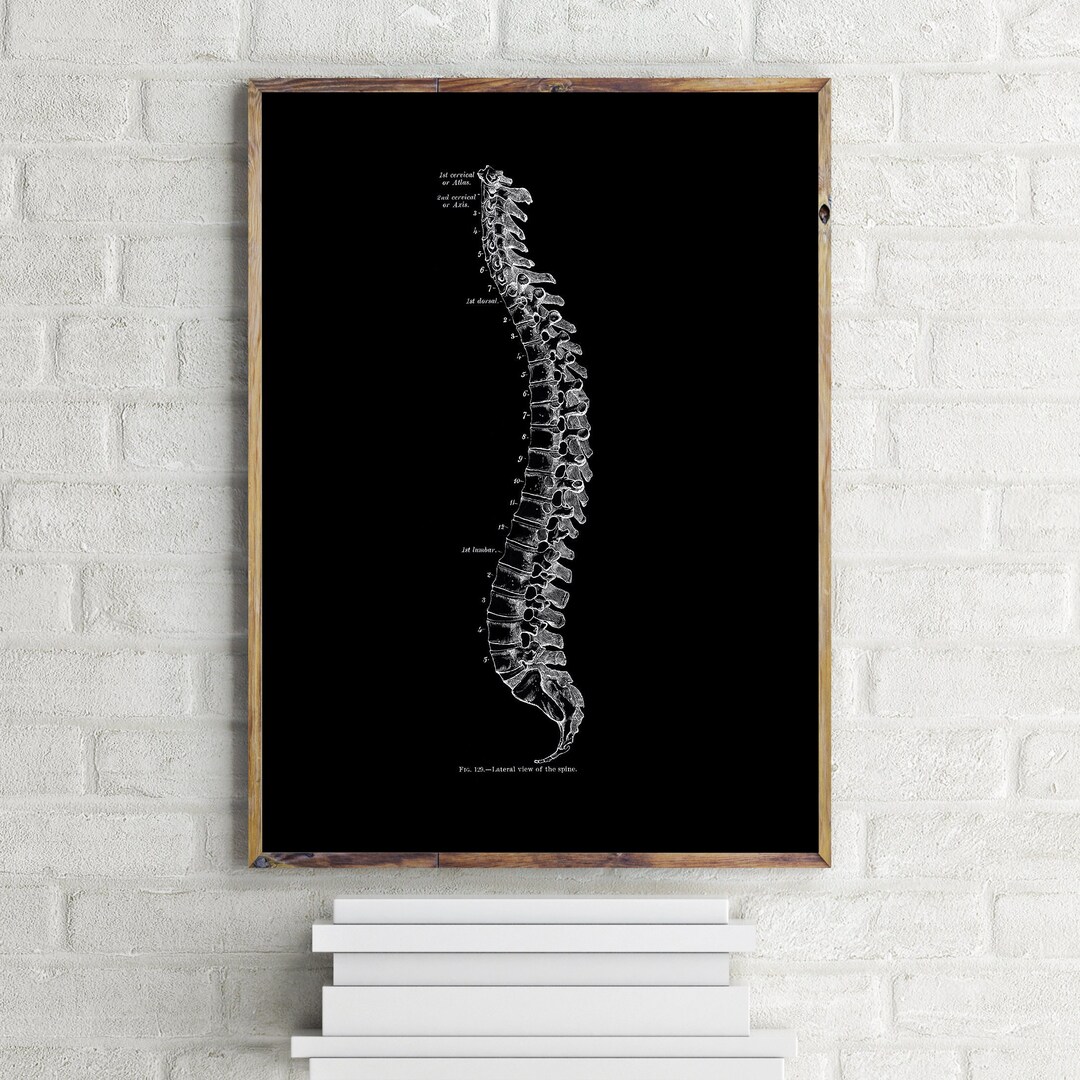 Vintage Lateral Spine Osteology Vertebrae Spinal Surgeon Chiropractor ...