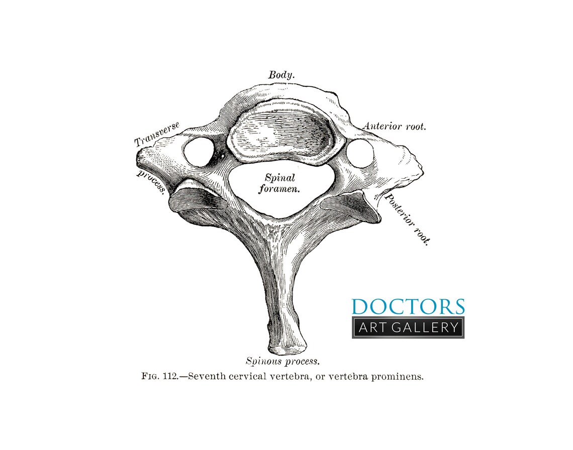 Vertebra Prominens Cervical Spine Bone Vintage Osteology Human Anatomy ...