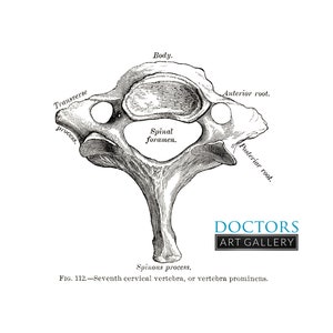 Vertebra Prominens Cervical Spine Bone Vintage Osteology Human Anatomy ...
